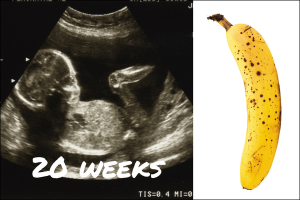 Week 20 Pregnancy: Fruit, Belly & Symptoms • Kopa Birth®