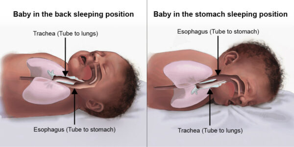 When Can Babies Sleep On Their Stomach (Q&A) • Kopa Birth®
